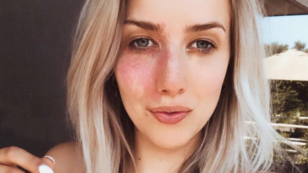 Laura Lieckens (Blind Getrouwd) straalt zonder make-up in bikini: "I ...