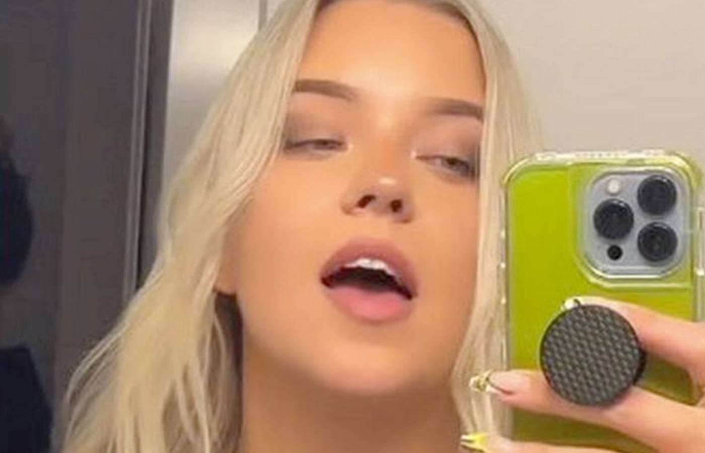 TikTokster met herpes openhartig: “Ik heb nog altijd gigantisch veel succes bij mannen” (video ...